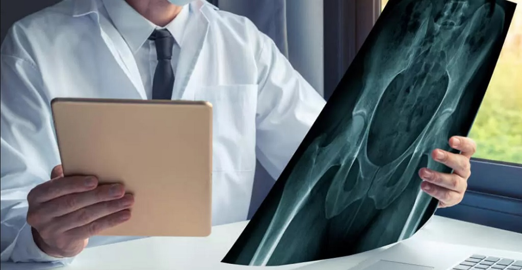 De ce ar trebui să consulți un medic ortoped în caz de dureri osoase ...